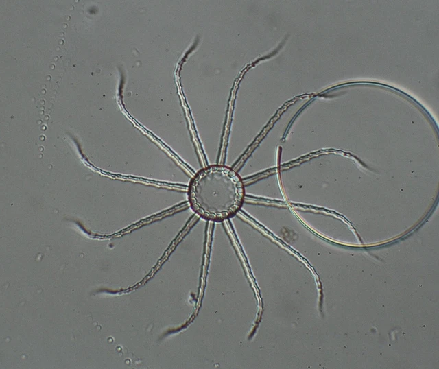 VINTAGE MICROSCOPE SLIDE. A Strew Including Bacteriastrum Diatoms £49. ...