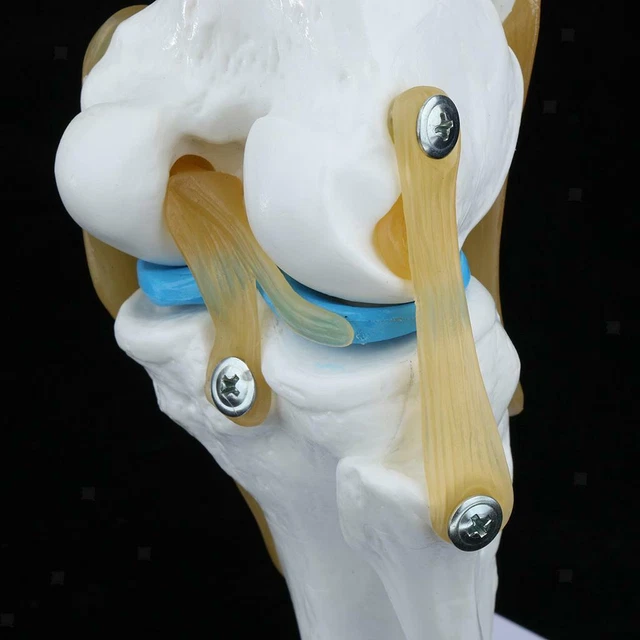 HUMAN KNEE JOINT Anatomy Models Skeleton Model Nursing Teaching ...