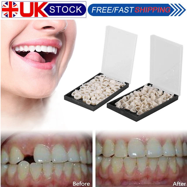 TEMPORARY CROWN POSTERIOR Anterior Molar Resin Tooth Teeth Caps Dental ...