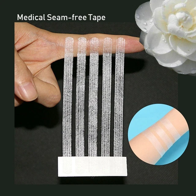 EMERGENCY SKIN WOUND Strip Surgery Postpartum Seam-free Sticker Beauty ...