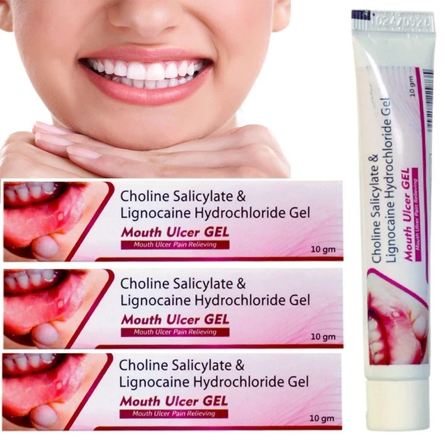 MOUTH ULCER GEL Fast-Acting Healing and Soothing Canker Sores and Gums ...