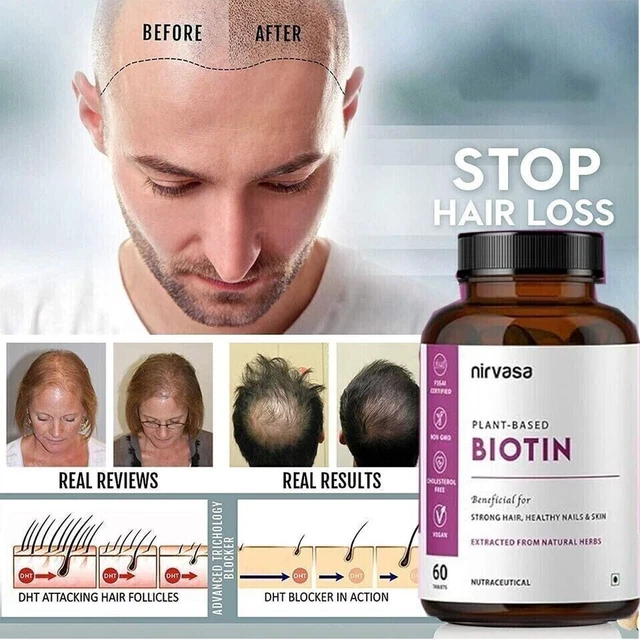 DHT BLOCKER HAIR Fast Growth Herbal Prevent Anti Hair Loss Treatment 60 ...