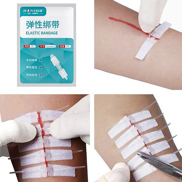 ZIPPER TIE WOUND Closure Patch Hemostatic Patch Wound Fast Suture ...