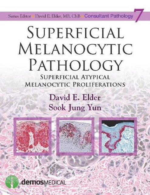 SUPERFICIAL MELANOCYTIC PATHOLOGY: Superficial Atypical Melanocytic ...