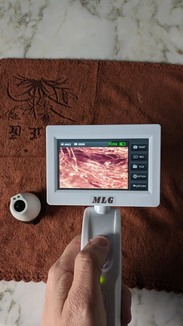 MICROSCOPIO DIGITALE TOUCH Screen- Dermatoscopio, Tricoscopio, Tricomi ...