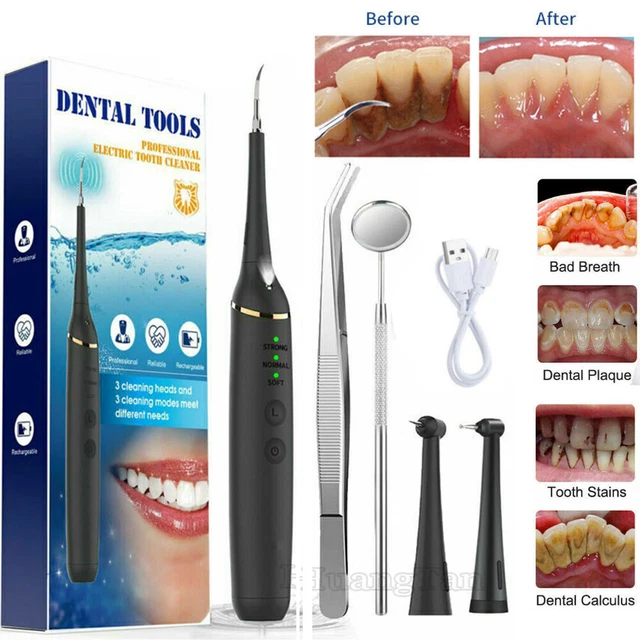 ELECTRIC TOOTH CLEANER Dental Tools Plaque Calculus Remover Teeth ...