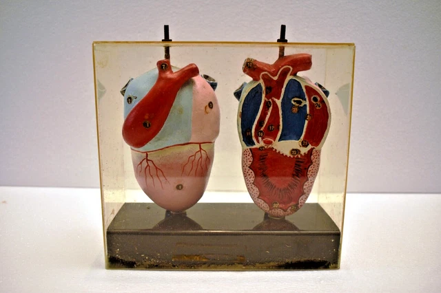 VINTAGE ANATOMICAL HEART Model in Acrylic Case Educational Medical ...