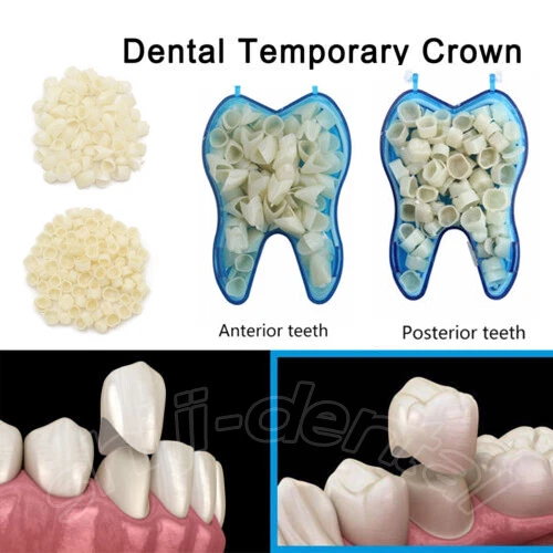DENTAL RESIN REALISTIC Porcelain Temporary Tooth Crown Anterior ...