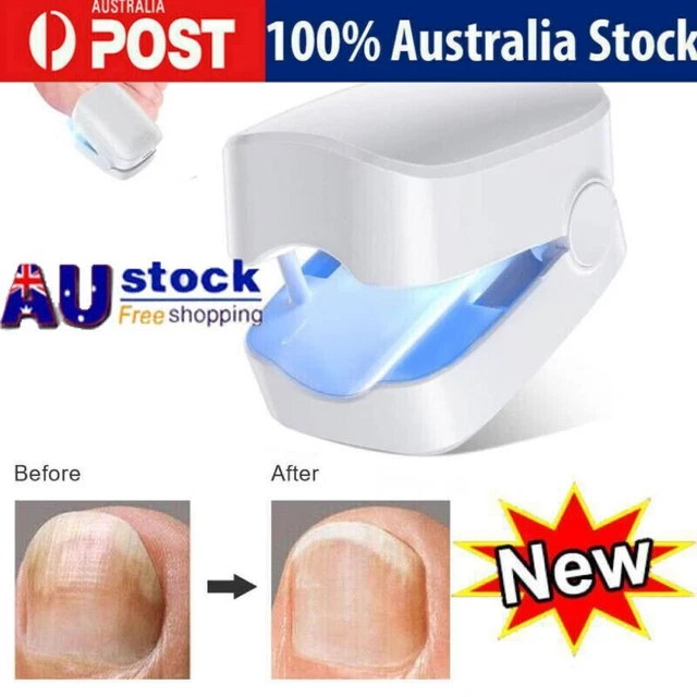 NAIL FUNGUS LASERS Treatment Device Fingernail Toes Infections Cleaning ...