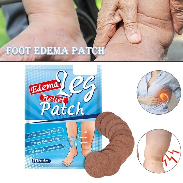 EDEMA LEG RELIEF Patch Varicose Veins Vasculitis Phlebitis Spider Leg D ...