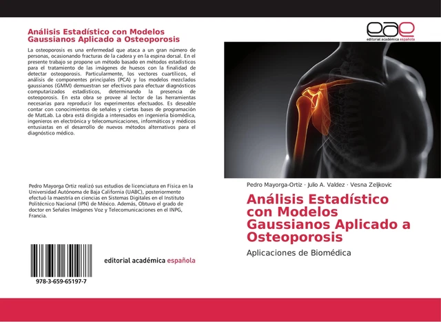 ANÁLISIS ESTADÍSTICO CON Modelos Gaussianos Aplicado a Osteoporosis Taschenbuch EUR 30,95 ...