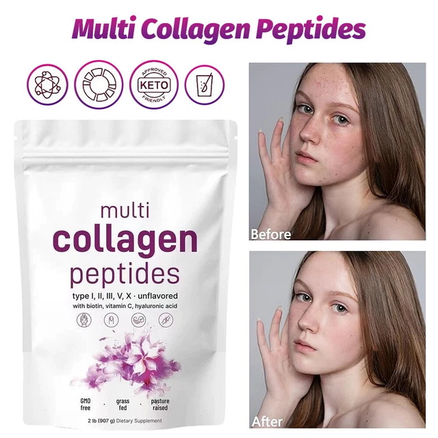 1/2LB MULTI COLLAGEN Peptides Powder-Hydrolyzed Protein Peptides Type l ...