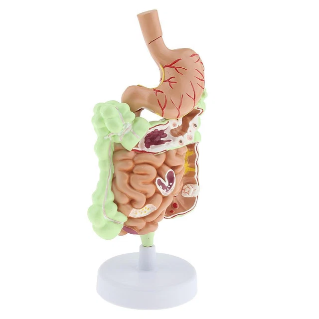 HUMAN ANATOMY DIGESTIVE System Model Human Stomach Gastrointestinal ...