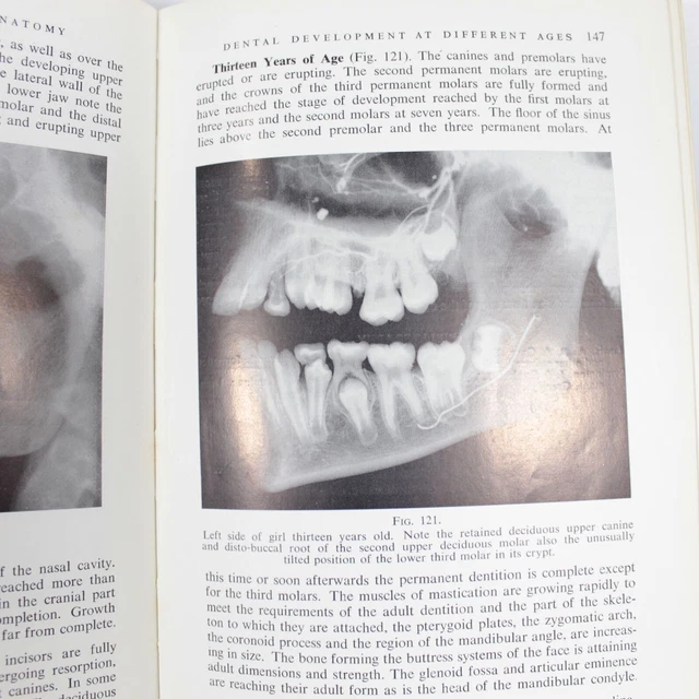 VINTAGE DENTISTRY BOOK Introduction To Dental Anatomy James Henderson ...
