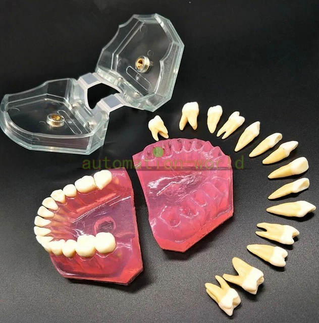 ONE DENTAL TEETH Model Study Teach Standard Model with Removable Teeth ...