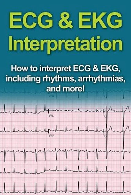 ECG & EKG Interpretation: How to interpret ECG & EKG, including rhythms ...
