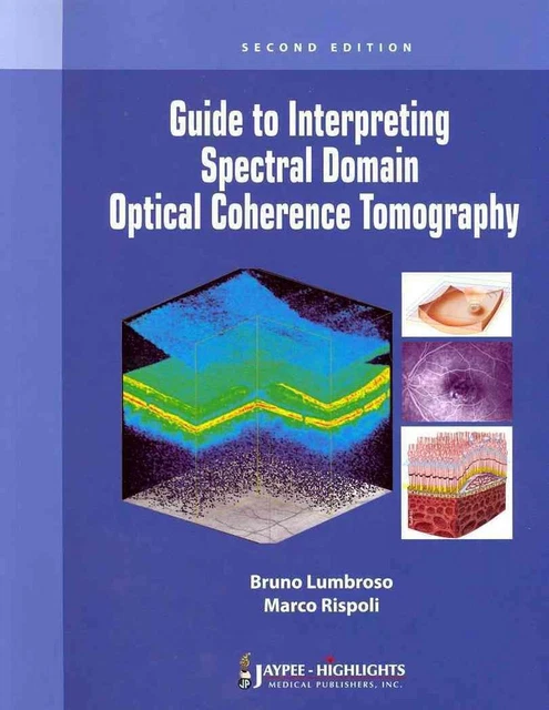 GUIDE TO INTERPRETING Spectral Domain Optical Coherence Tomography by ... GUIDE TO INTERPRETING Spectral Domain Optical Coherence Tomography by ...