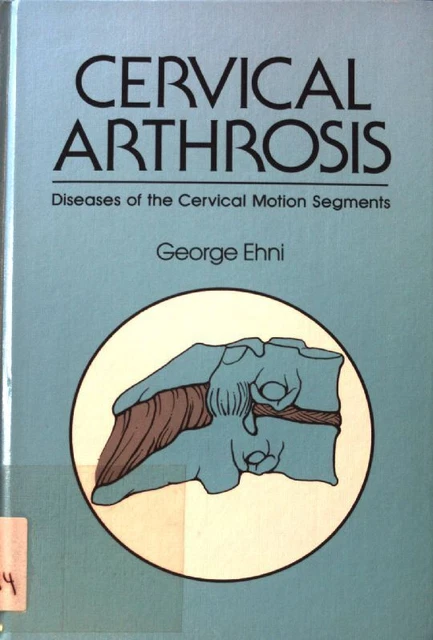 CERVICAL ARTHROSIS: DISEASES of Cervical Motion Segments. (Spondylosis ...