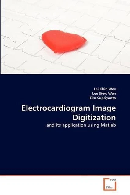 Electrocardiogram Image Digitization And Its Application Using Matlab