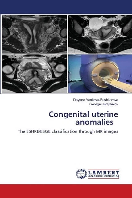 Congenital Uterine Anomalies By George Hadjidekov English Paperback Book Eur 4107 Picclick Fr