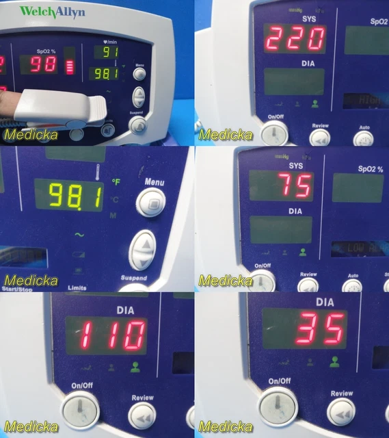 HILL ROM 53NTO Vitals Patientenmonitor mit NEUEM AKKU ...