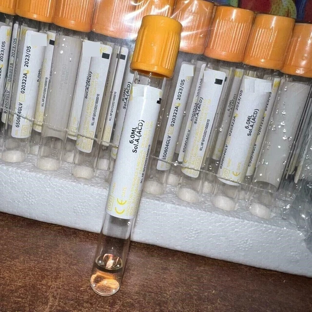 VACUTAINER BLOOD COLLECTION Acd Solution Tube 6 ML .16X100 Mm ( Pack of ...