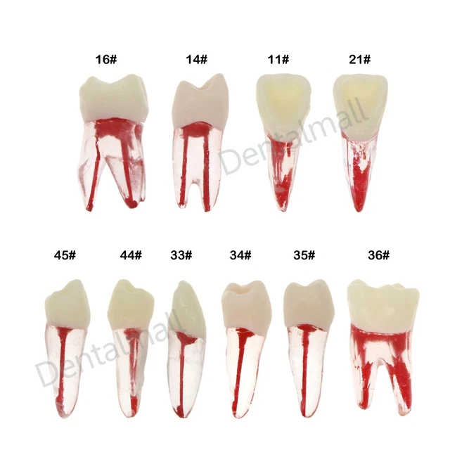 10 PCS DENTAL Root Canal Practice Model Teeth for Pulp Study RCT Endo ...