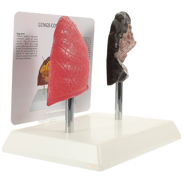 HUMAN BODY ORGANS Model Scientific Lung Model Human Anatomical Model £ ...