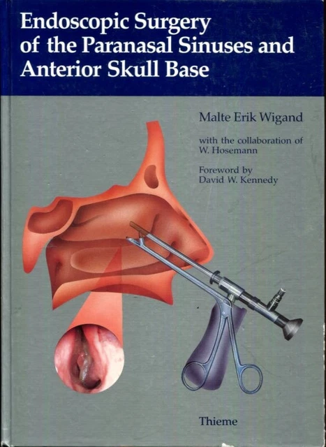 ENDOSCOPIC SURGERY OF the Paranasal Sinuses and Anterior Skull Base £48 ...