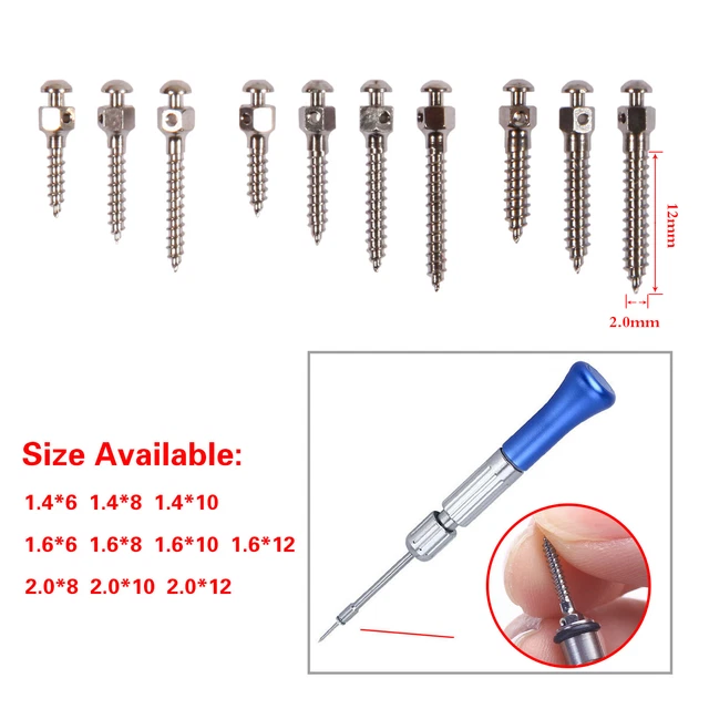DENTAL ORTODONCIA MICRO Mini Screw Tornillo auto-Taping/ Handle EUR 10 ...