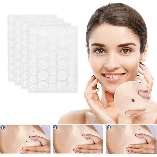 REMOVAL ACNE PIMPLE Patch 72 Pcs Plasters Patches Blemish Control ...