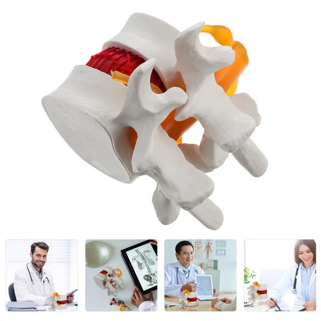 SPINE MODEL PVC Vertebrae Lumbar Disc Herniation Presentation Anatomy £ ...