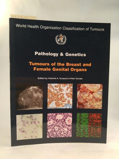 PATHOLOGY AND GENETICS of Tumours of the Breast & Female Genital Organs ...
