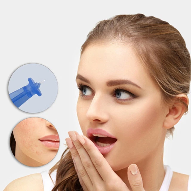 DISPOSABLE ACNE NEEDLES Small Incision Deep Cleansing Needle For Face ...