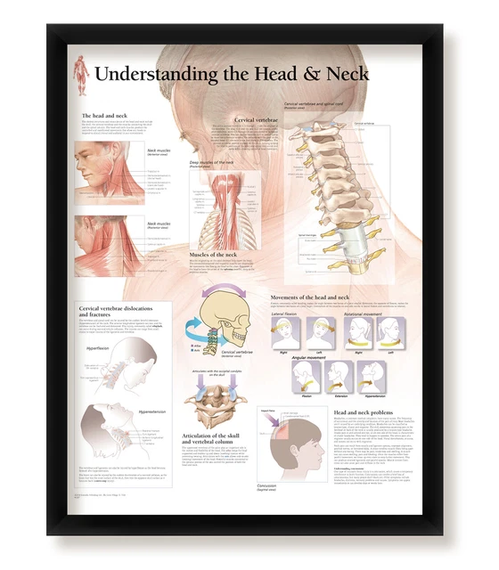 MEDICAL POSTER UNDERSTANDING The Head and Neck Wall Diagram Doctors ...