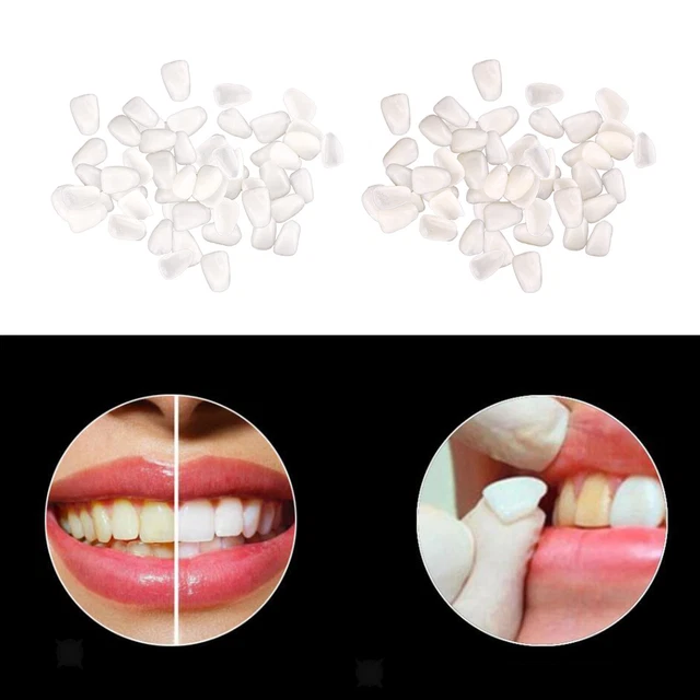 -THIN TEETH TOOTH Temporary Veneers Anterior Synthetic Mixed Type EUR 6 ...