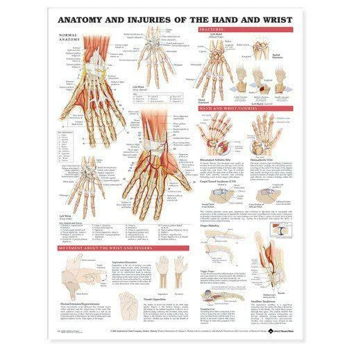 ANATOMY AND INJURIES of the Hand and Wrist Anatomical Chart by ...