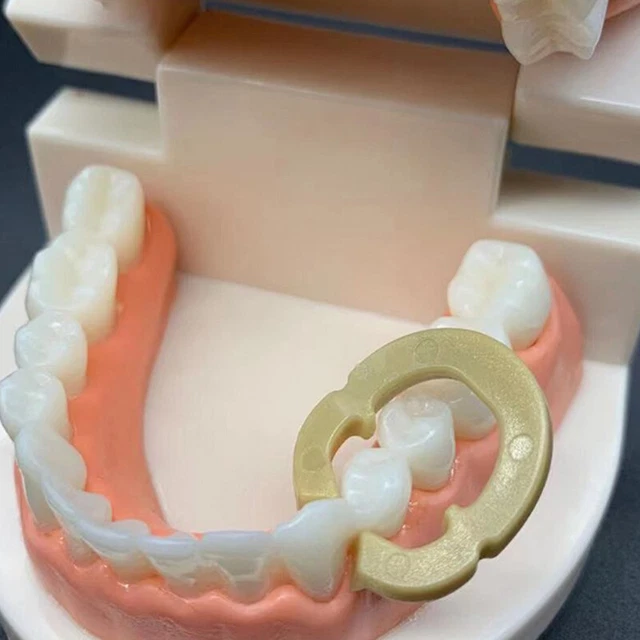 DENTAL RESIN CLAMPING Ring Separator Ring Matrices Holder Matrix Fixed ...