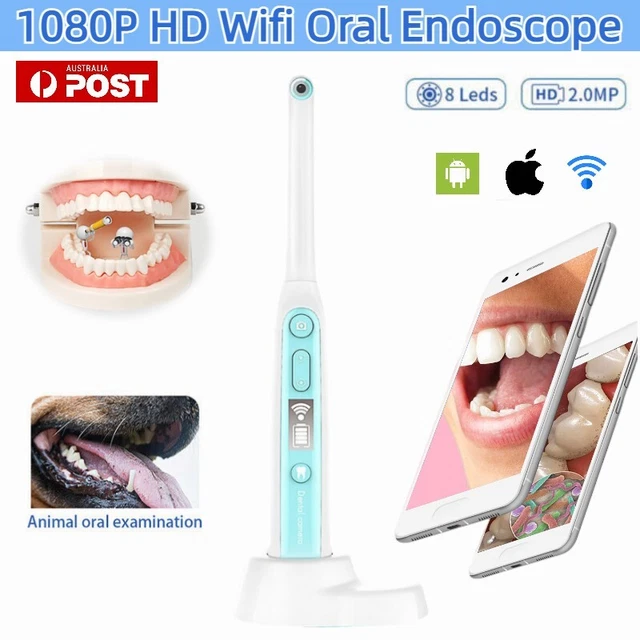 WIFI DENTAL INTRAORAL Camera Wireless Oral Endoscope USB Digital 1080P ...