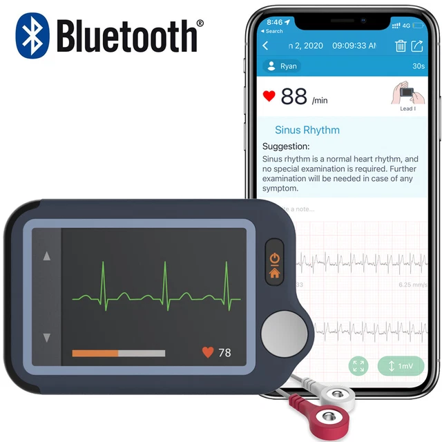 AI EKG MONITOR 30s/60s/5min Recording & Monitoring Heart Monitor App AI ...