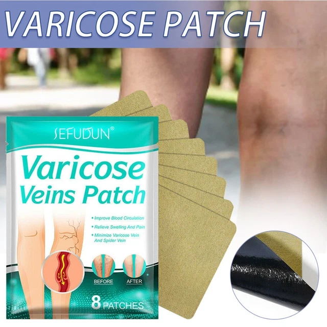 NEW VARICOSE VEINS Plaster Patch Vasculitis Phlebitis Spider Patch Leg ...