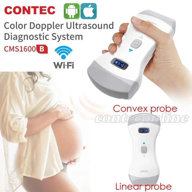 HANDHELD COLOR ULTRASOUND Scanner Double Head Probe Linear Convex ...