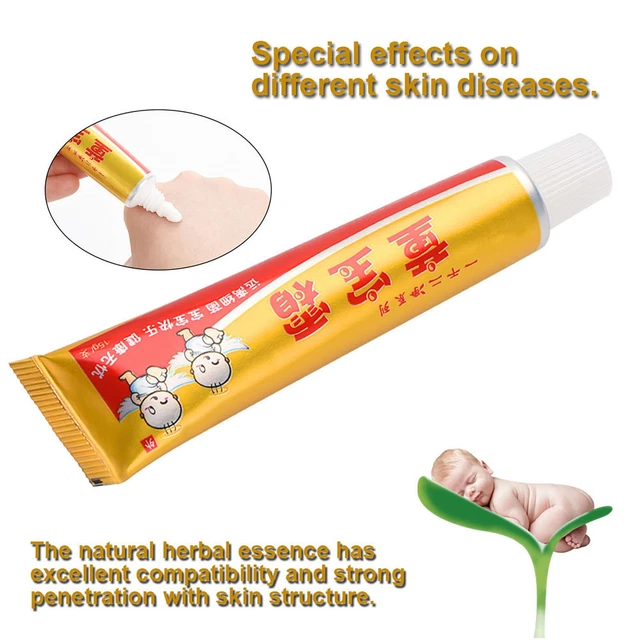 CHINESE ORIGINAL BODY Medicine Baby Cream Eczema Treatment For Skin ...