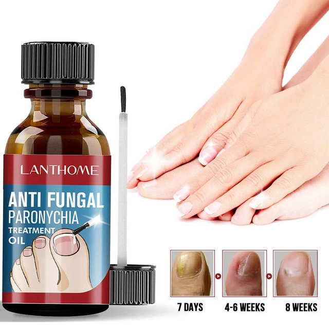 Best German Toenailplus Nailprop Anti Paronychia Relief Oil N E W 20 B8