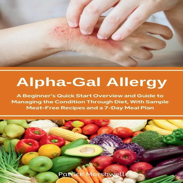 ALPHA-GAL ALLERGY A Beginner's Quick Start Overview and Guide to £11.63 ...