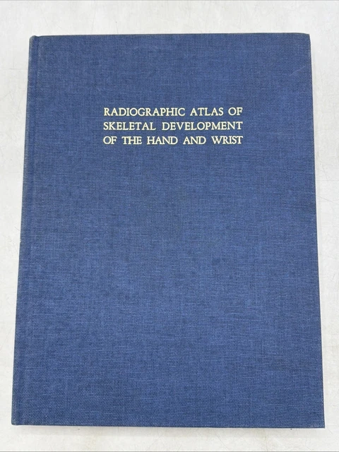 RADIOGRAPHIC ATLAS OF Skeletal Development of the Hand and Wrist. 2nd ...