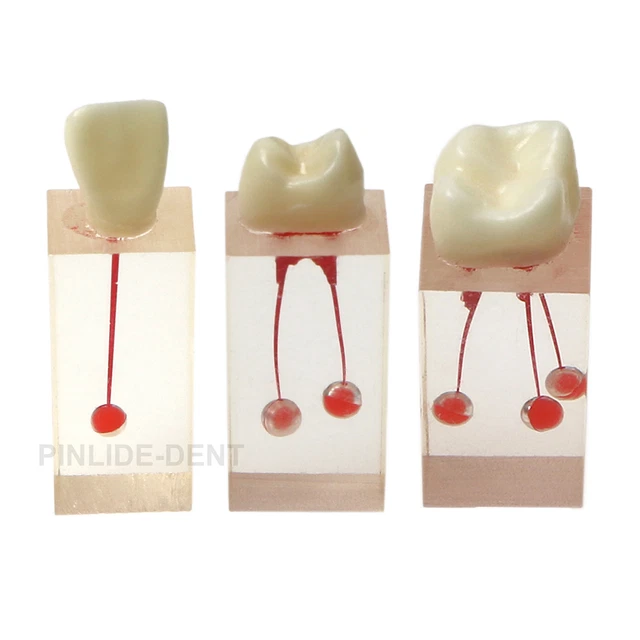 5* DENTAL TEETH Model Root Canal Practice Block RCT Pulp Cavity Endo ...