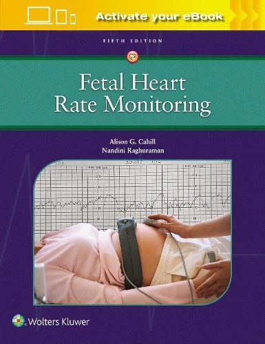 ALISON CAHILL NANDINI Raghuraman Fetal Heart Rate Monitoring (Poche ...