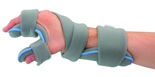 NHS FUNCTIONAL HAND Orthosis - Soft Malleable Padded Wrist & Hand ...