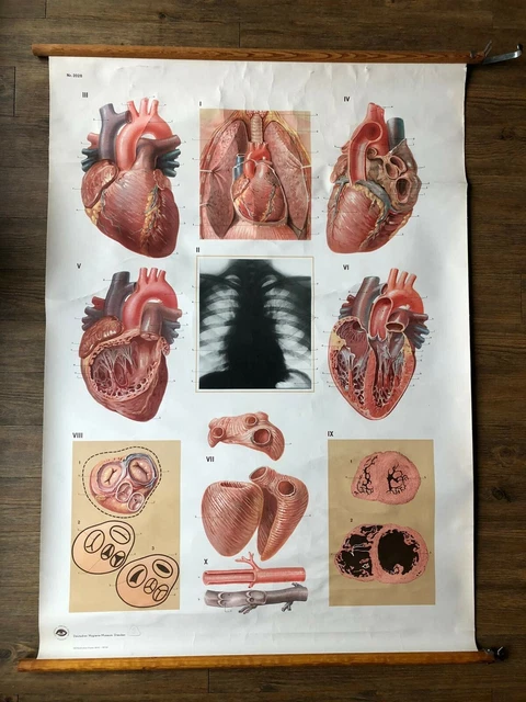 VINTAGE GERMAN WALL chart - Human anatomy of the heart - Like Jung Koch ...